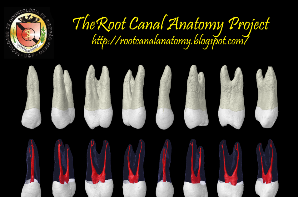 Maxillary First Premolar Root Canal Anatomy Hot Sex Picture