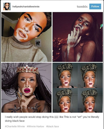 Introduzir 122 Imagem Modelo Brasileira Com Vitiligo Brthptnganamst