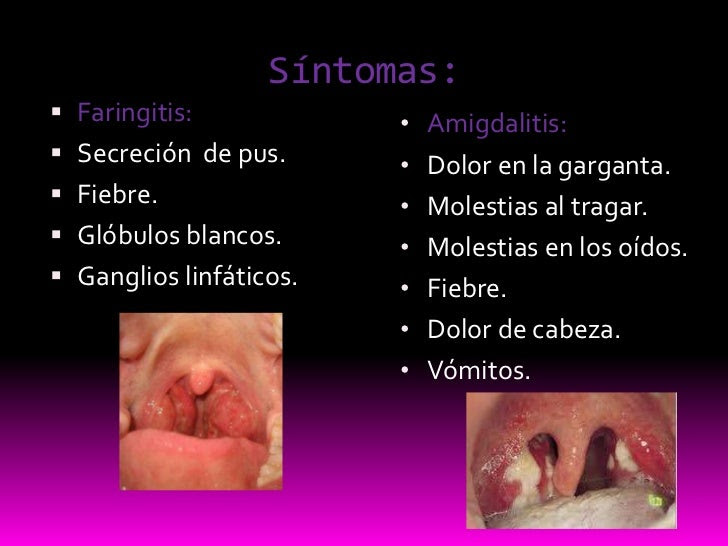 Sintomas Del Cancer De Garganta