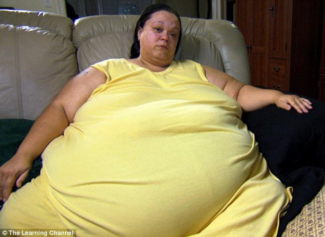 Welcome To Angel Ojukwus Blog Morbidly Obese Mother Of Two Is Told