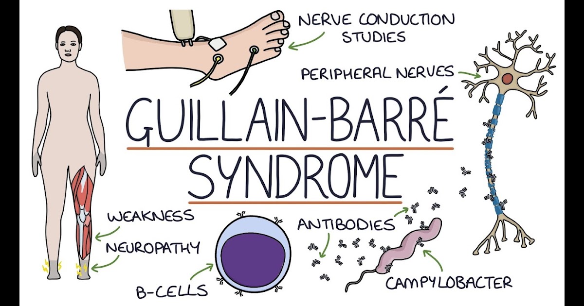 Guillain Barré Syndrome Introduction To Guillain Barre Syndrome