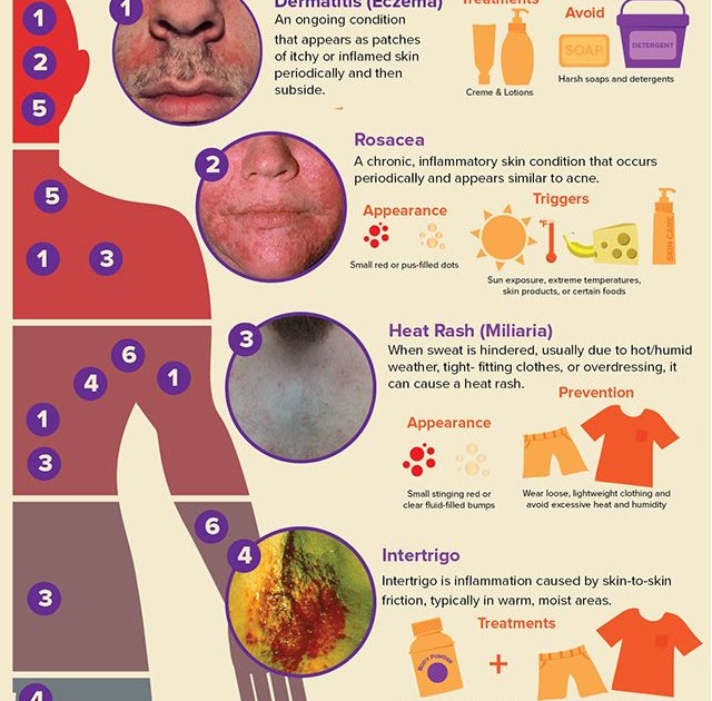 Common Rashes Infographic Nursing School Nurse Medica