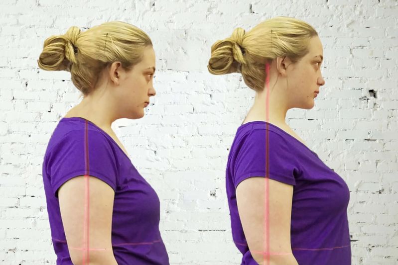 5 Effective Exercises To Get Rid Of Hump On Neck