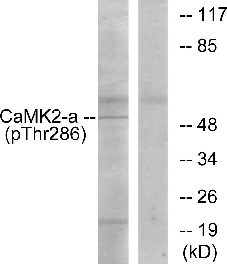 Anti Camk2 Camkii Antibody Rabbit Anti Human Polyclonal Lsbio