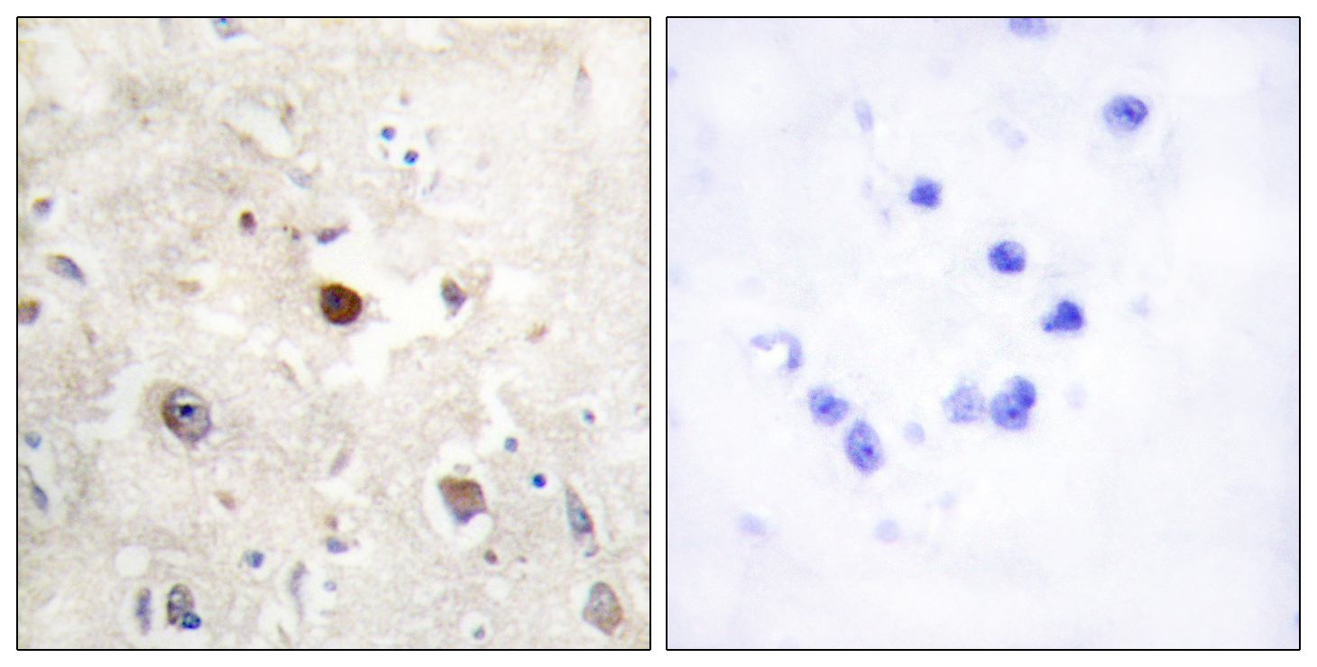 Anti Cdkn1c P57 Kip2 Antibody Rabbit Anti Human Polyclonal Lsbio