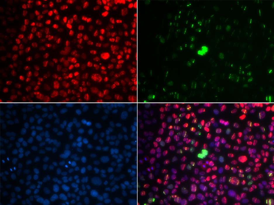 Anti Atm Antibody Rabbit Anti Human Polyclonal Ifihcwb Lsbio