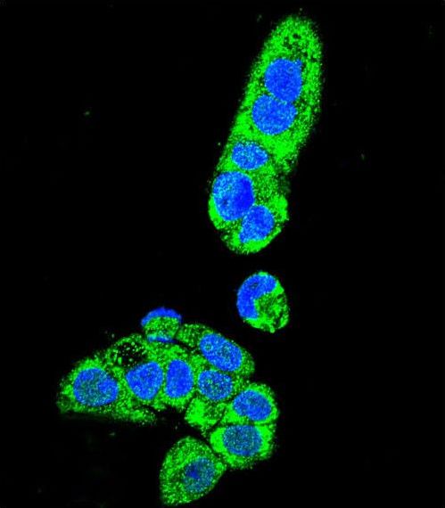 Anti Fah Antibody Rabbit Anti Human Polyclonal Ifihcwb Lsbio