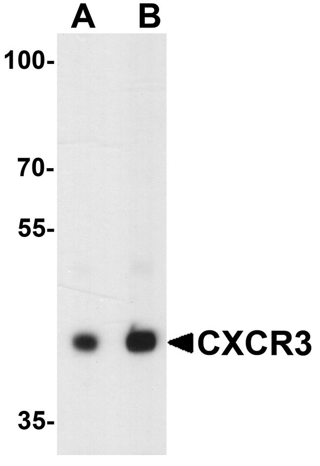 Ihc Plus™ Cxcr3 Polyclonal Antibody Rabbit Anti Human Lsbio