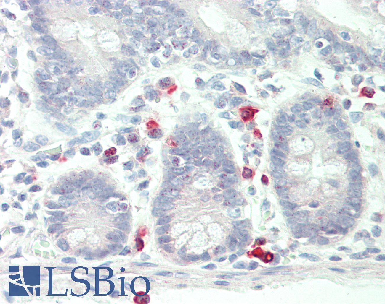 Ihc Plus™ Cd40l Polyclonal Antibody Rabbit Anti Human Iccihcwb Lsbio