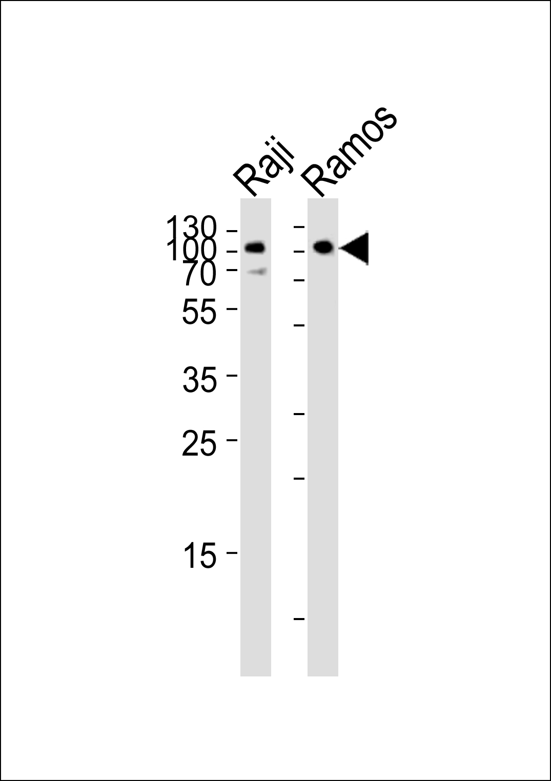 Ihc Plus™ Cd19 Polyclonal Antibody Rabbit Anti Human Ihcwb Lsbio