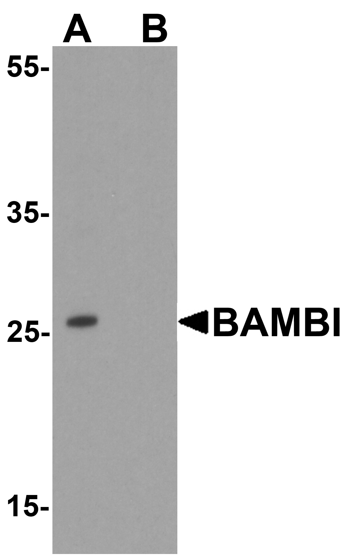 Ihc Plus™ Bambi Polyclonal Antibody Rabbit Anti Human Lsbio