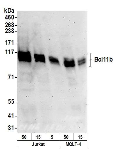 Ihc Plus™ Bcl11b Polyclonal Antibody Rabbit Anti Human Ihcipwb Lsbio