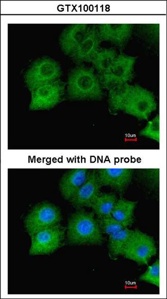 Ihc Plus™ Gapdh Polyclonal Antibody Rabbit Anti Human Lsbio