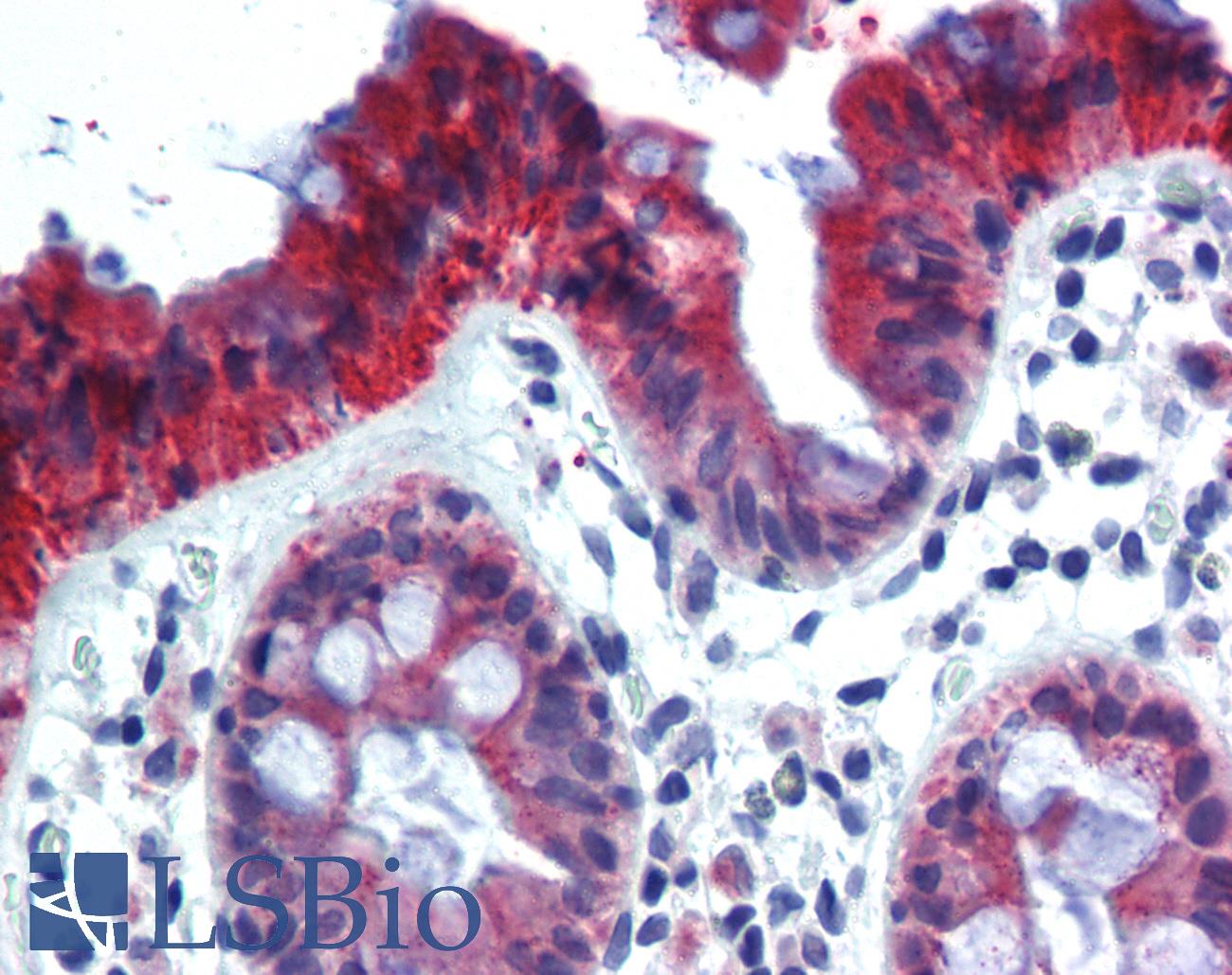 Ihc Plus™ Krt18 Ck18 Cytokeratin 18 Monoclonal Antibody Fitc Lsbio