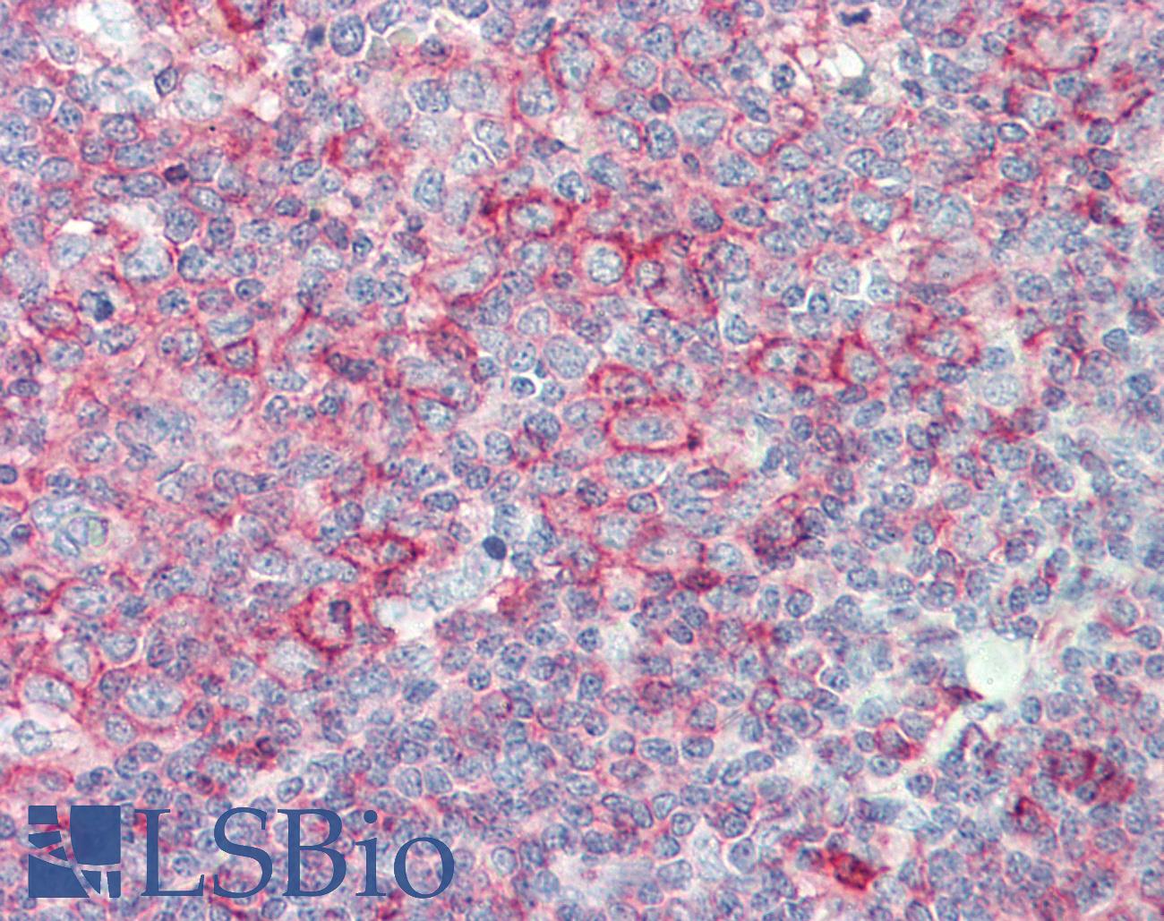 Ihc Plus™ Hla B Polyclonal Antibody Rabbit Anti Human Lsbio