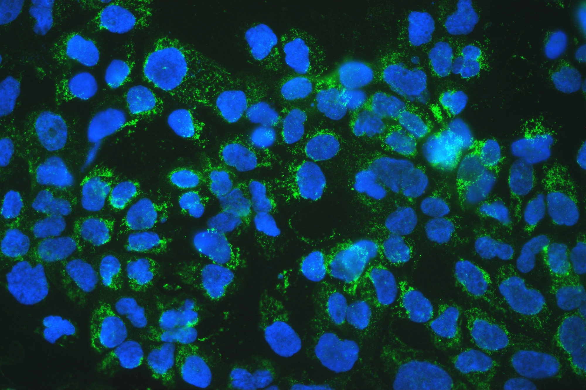 Anti Mttfa Tfam Antibody Rabbit Anti Human Polyclonal Ihcwb Lsbio