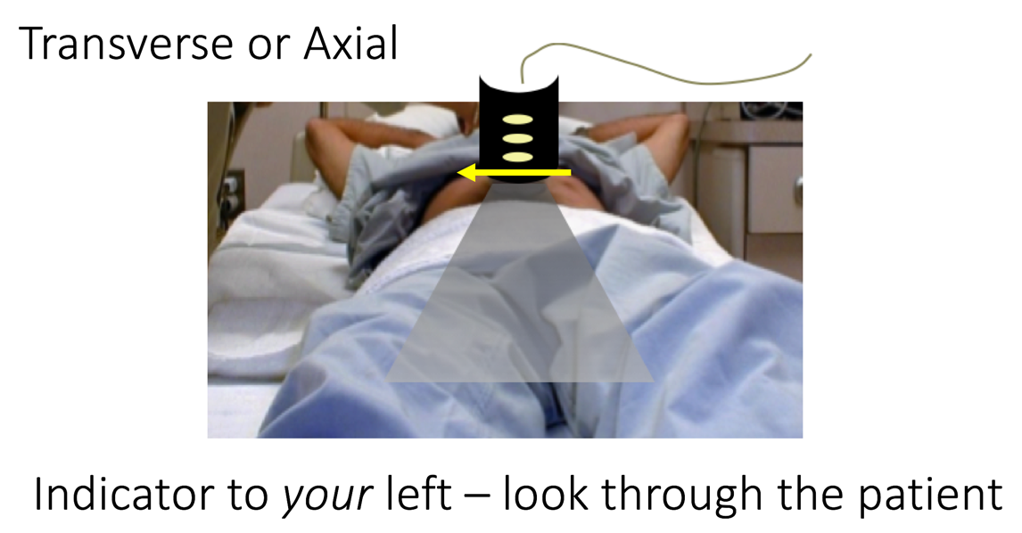 Ultrasound Basics Transverse Plane