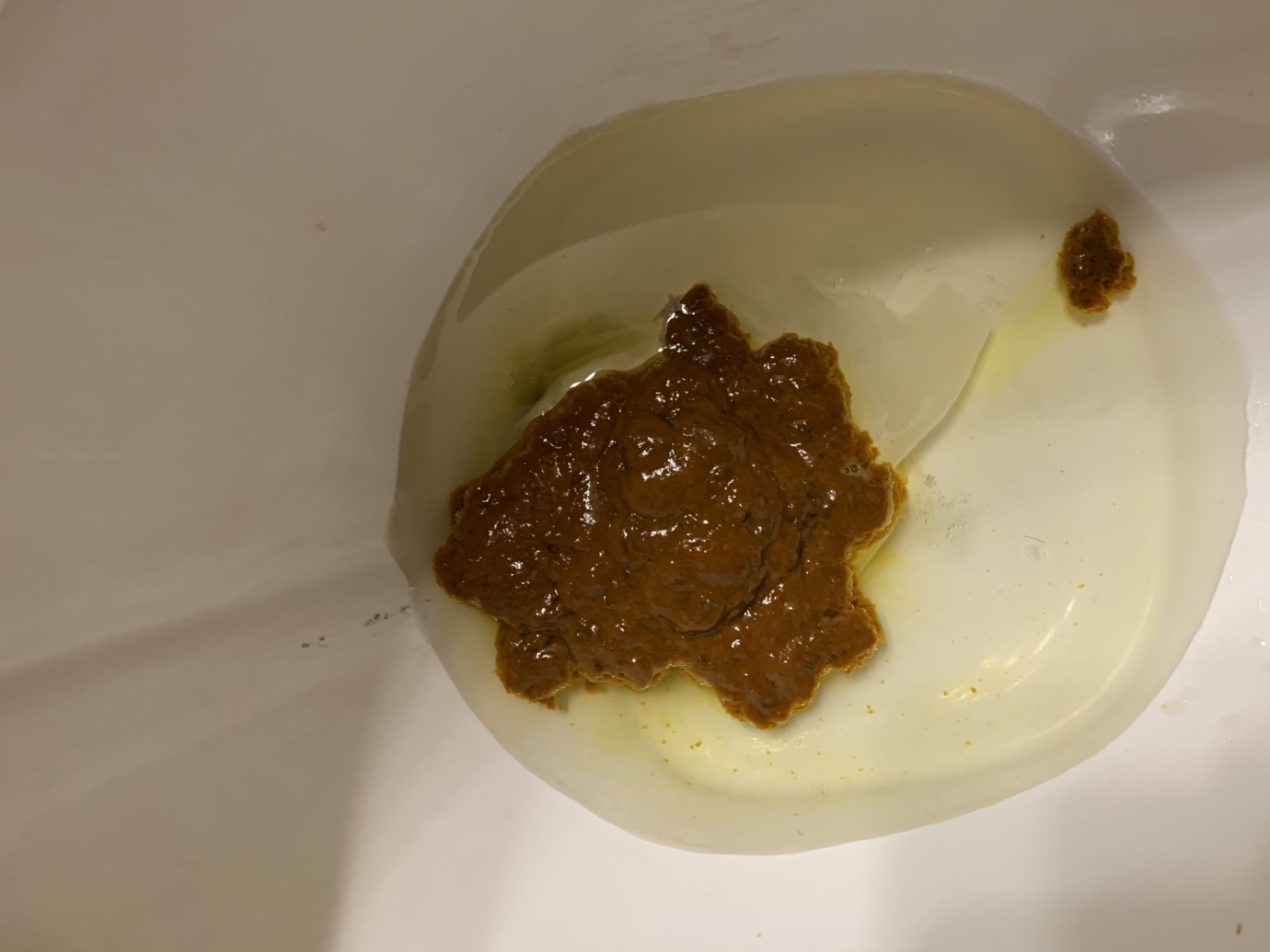 Why Does My Poop Smell Like A Virus At Gary Dyer Blog