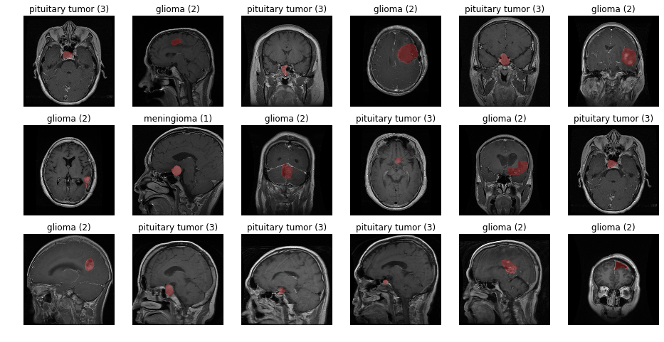 Brain Tumor Mri Dataset