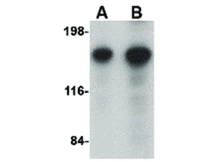 Caps1 Antibody 600 401 Ab0 Rockland