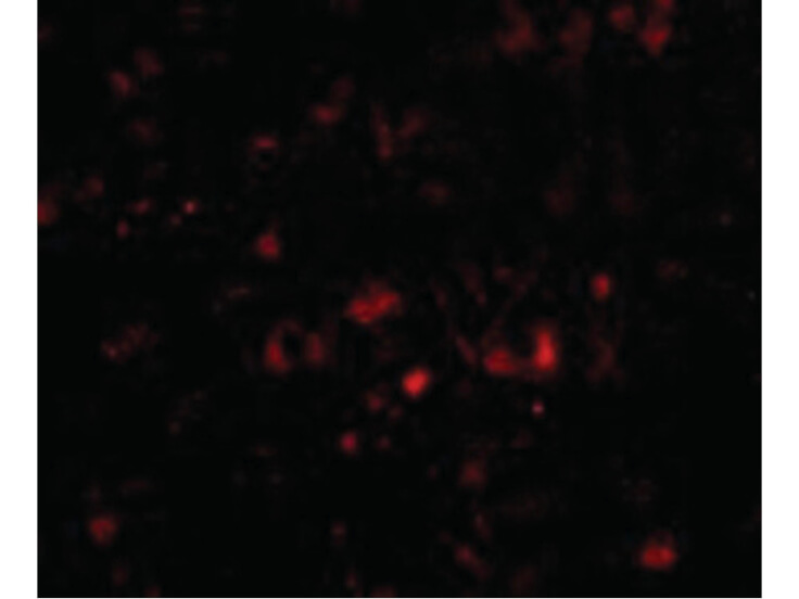 Nptx2 Antibody 600 401 De5 Rockland