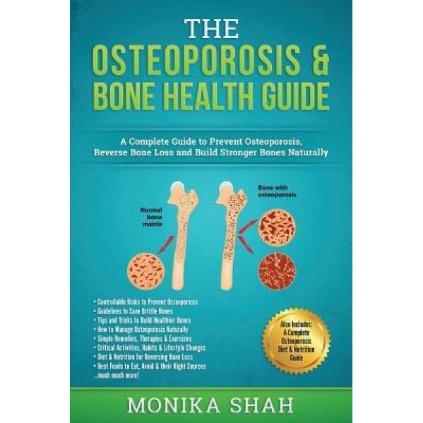 Osteoporosis The Osteoporosis And Bone Health Guide A Complete Guide To