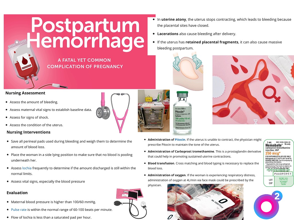 Postpartum Hemorrhage Nursing Maternity Nursing Showme