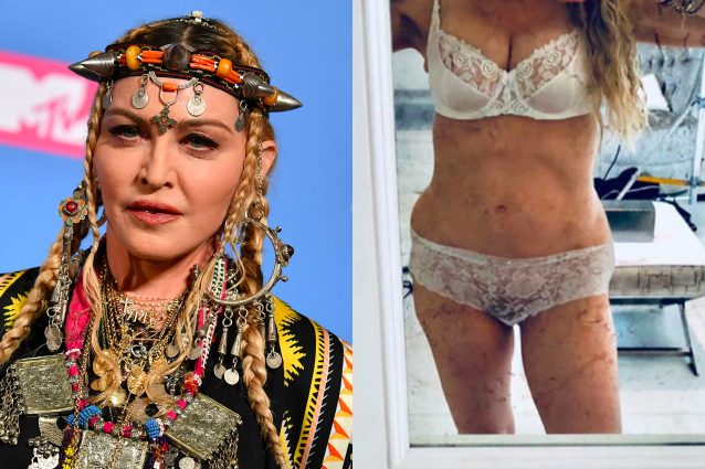 Madonna In Intimo Per La Prima Volta Mostra Il Corpo Nudo Senza Filtro